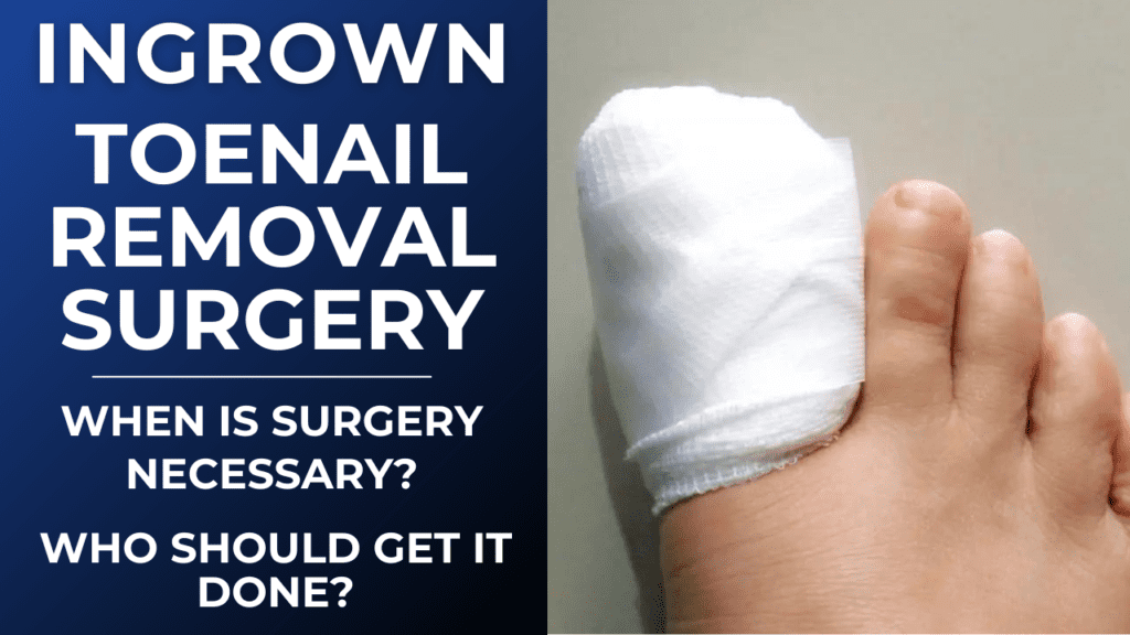 What is Ingrown Toenail removal surgery? How does it work? Does it hurt?
